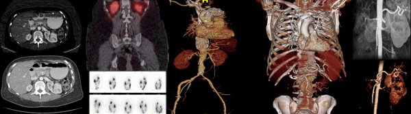 UAB - School of Medicine - Radiology - Abdominal Imaging